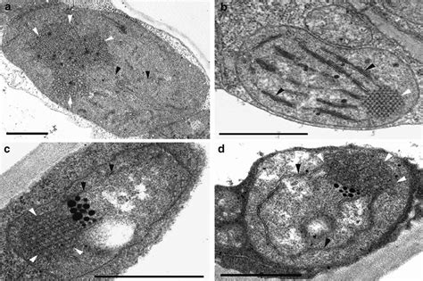 1 Electron Micrographs Representing An Etioplast Of An Etiolated