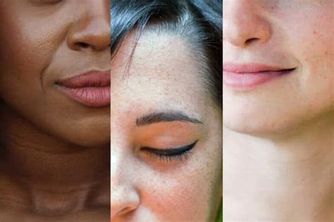 Yellow Skin Tone Causes And Treatments Jaundice And More Skin