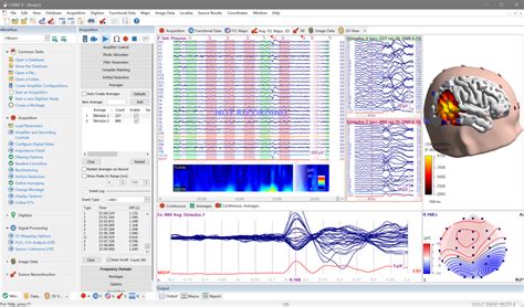 Upgrade To Curry 9 Compumedics Neuroscan