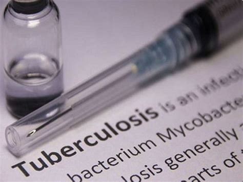 Community Should Play Proactive Role In Fight Against Tuberculosis