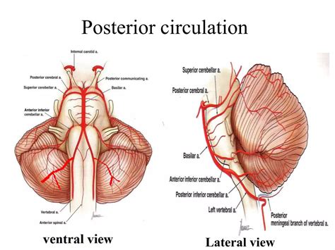 Posterior Circulation Stroke Syndromes Ppt