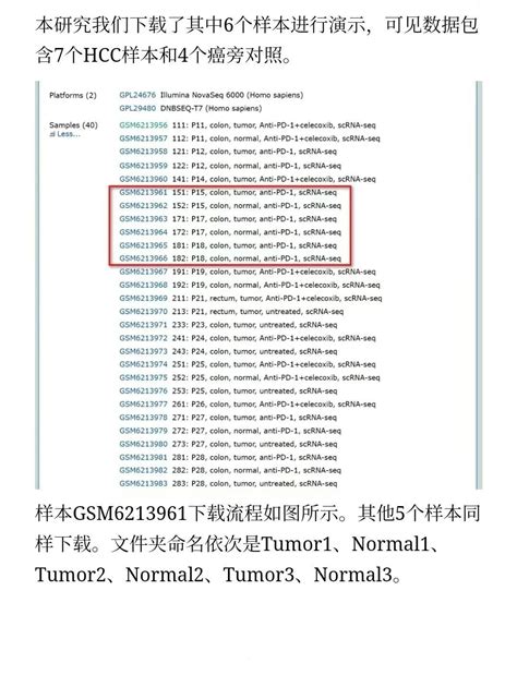 单细胞转录组全流程分析，终于搞懂了！