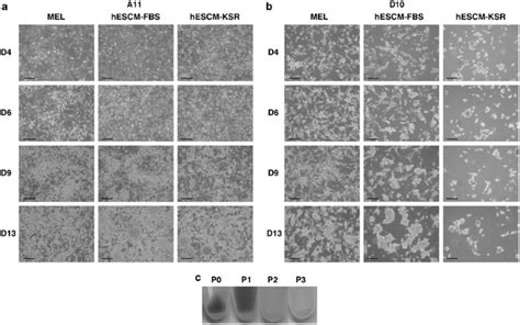 Inverse Expression States Of The BRN And MITF Transcription Factors In Melanoma Spheres And