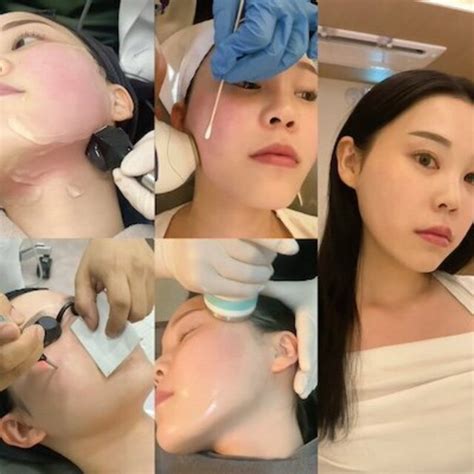 ダウンタイムなし痛みなし 韓国在住美容ライターが教えるおすすめ美容施術4選たるみ毛穴など肌悩み別に紹介韓国BeautyTalk