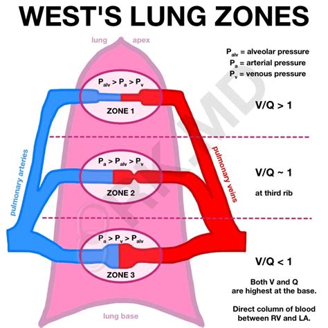 Wests Lung Zones Rk Md