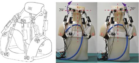 6 Sps Cs Parallel Manipulator Cervical Exoskeleton [86] Download Scientific Diagram