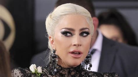 Beauty Eingriffe Lady Gaga Verändert Sich Immer Mehr