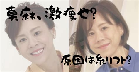 高橋真麻やつれてる理由を調査！原因は糸リフト？整形説も深掘り Coco Navi ココナビ