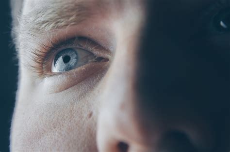 Yeux Globuleux Que Faire Comment Lutter Contre Les Yeux Globuleux