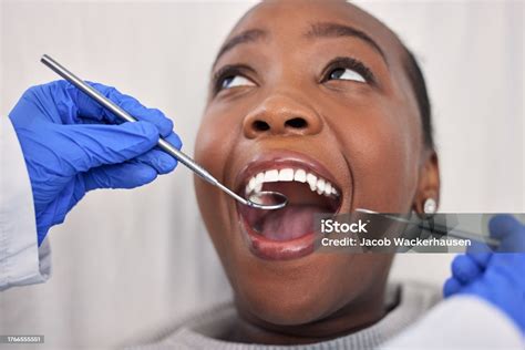 치과 의사의 손 환자의 입 및 도구는 치아 건강 및 치료를 위해 치아를 확인합니다 구강 위생 건강 관리 및 교정 충치가 있는