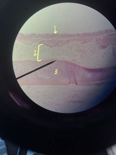 Trachea Microscope Flashcards Quizlet