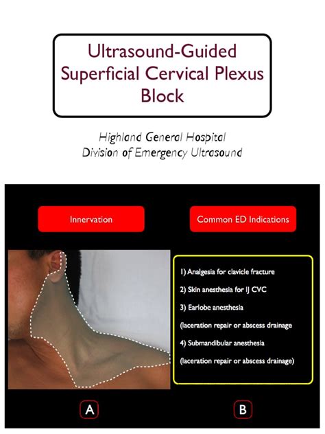 Scp Block How To Pdf