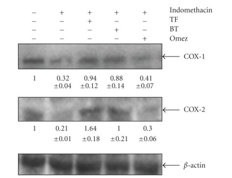Immunoblots Of The Cox 1 And Cox 2 Expressions In The Stomach Tissues