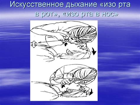 Терминальные состояния организма Лекция 3 презентация онлайн