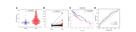 The Expression And Clinical Significance Of Pgd In Tcga Database A