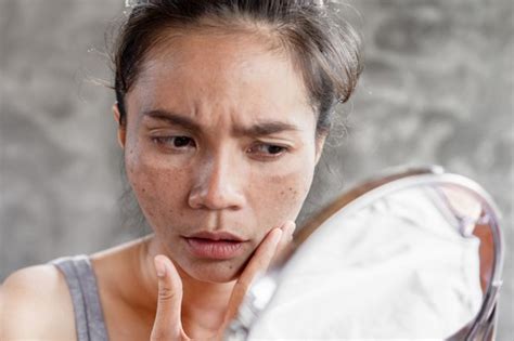 Ini 5 Penyebab Warna Kulit Tidak Merata Wajib Tau — Kover Magazine