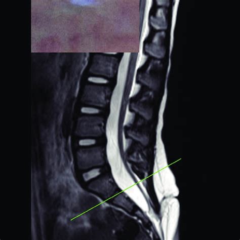 Average Delay Versus Lag 1 Auto Covariance Of The Service Process With Download Scientific