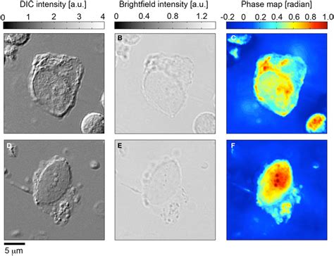 Quantitative Phase Microscopy Of Circulating Tumor Cells Comparison To Download Scientific