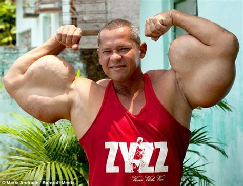 27 Synthol Transformations So Extreme You Won T Believe They Re Real