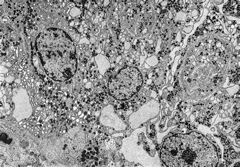 Retículo Endoplasmático Foto De Archivo Imagen De Derecho 345405508