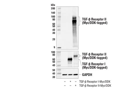 Csttgf Beta Receptor Ii E5m6f Rabbit Mab优宁维univ商城