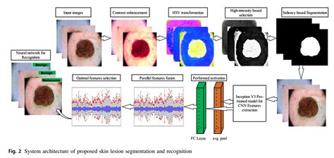 Github Rashidrao Pkan Integrated Framework Of Skin Lesion Detection