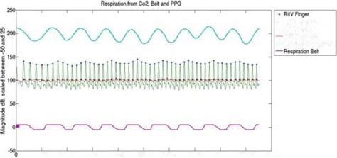 Figure L Comparison Of Respiration Rate Derived From End Tidal C02