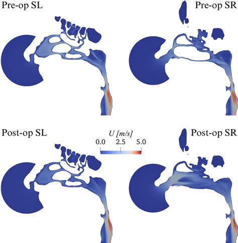 Cfr Comparison Magnitude U Of The Mean Velocity Vector In Planes Sl And Sr Download