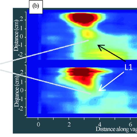 Test 3 Probe Rotation Results Tactile Imaging Marker At Distal Lateral Download Scientific