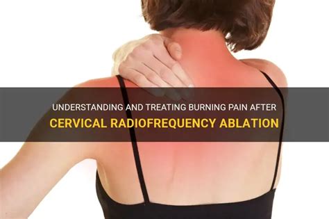 Understanding And Treating Burning Pain After Cervical Radiofrequency