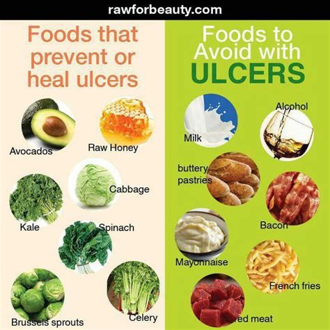 40 Best Ulcers Recipes Images On Pinterest Natural Remedies Natural