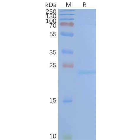 Human Tm4sf1 Full Length Protein Synthetic Nanodisc Dima Biotechnology
