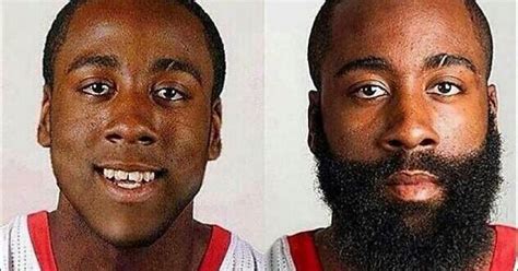 Why Does James Harden Without A Beard Look Like His Slower Cross Eyed
