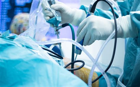 Did You Know Arthroscopy Not Recommended For Degenerative Knee