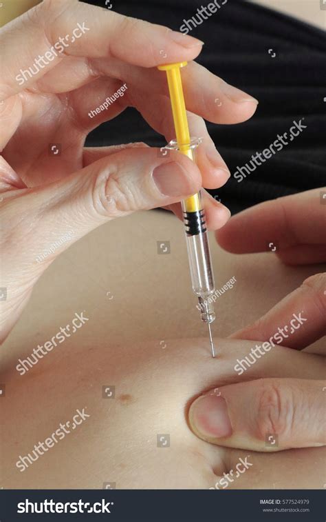 Heparin Subcutaneous Injection Sites