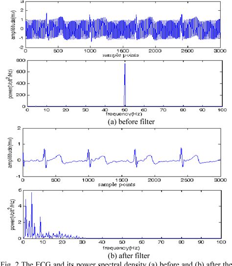 Figure 2 From Comparison Of Median Filter And Discrete Dyadic Wavelet Transform For Noise