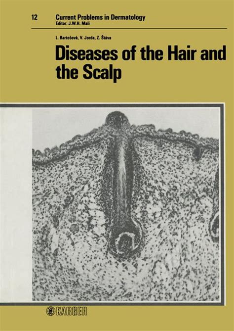 Diseases Of The Hair And The Scalp Books Gateway Karger Publishers
