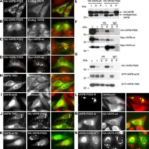 Vapb P56s Recruits Both Wild Type Vapa And Vapb A B Hela Cells