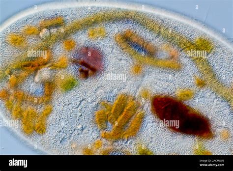 Frontonia Protist Differential Interference Contrast Micrograph Of The Large Freshwater Ciliate