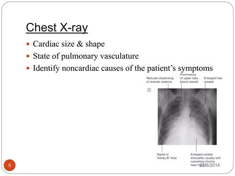 Heart Failure Diagnosis And Differential Diagnosis Pptx