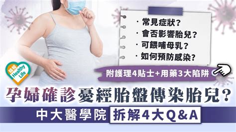 新冠肺炎︳孕婦確診憂經胎盤傳染胎兒？ 中大醫學院拆解4大qanda︳附護理4貼士用藥3大陷阱