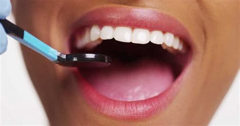 Tonsil Stones And Tonsillitis How To Tell The Difference