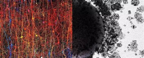 不是三维？科学家发现人的大脑里可能有11个维度！ 知乎