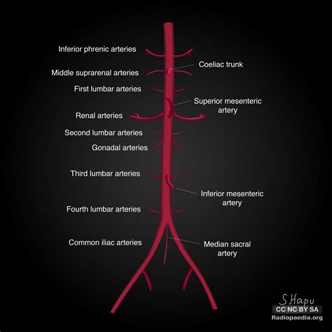 Aorta Branches Diagram