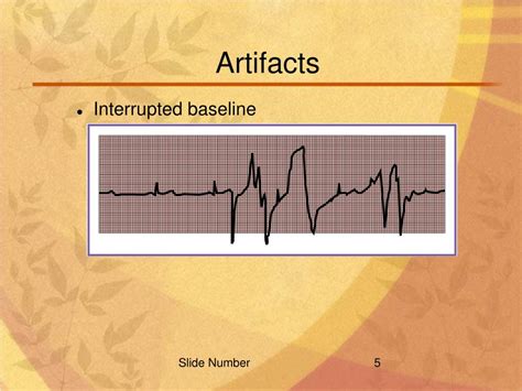 Ppt Obtaining An Ecg Powerpoint Presentation Free Download Id690637