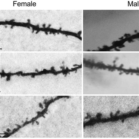 Photographs Of Third Order Dendritic Segments Of Dorsal Hippocampal Ca3