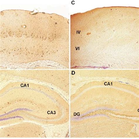 A Coronal Section Of Mouse Brain Showing The Pattern Of Immunostaining