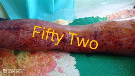 ပေါက်မြို့နယ်၊ ယာကြီးပြင်ကျေးရွာမှ အပြစ်မဲ့ပြည်သူ ၂ ဦးအား Pdf အကြမ်းဖက