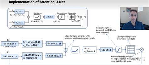 Attention Unet 知乎