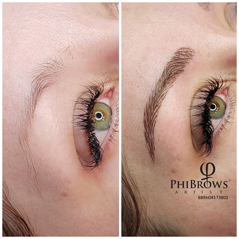 Lymphatic Drainage Skin Solution Hamilton